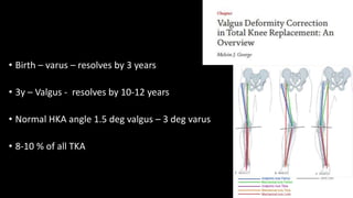 Valgus total knee arthroplasty | PPTX