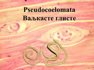 Valjkaste gliste | PPT