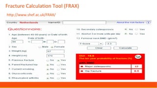 Seminar 26-11-10 - Vallen en fractuurrisico | PPT