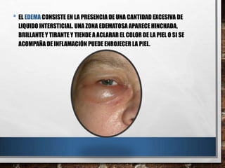 Valoración de la piel | PPTX