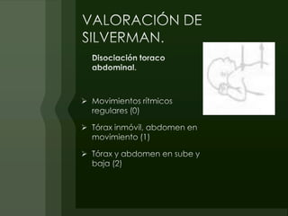 Valoración de silverman | PPTX