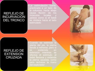 Valoración neurológica clasificacion de reflejos | PPTX