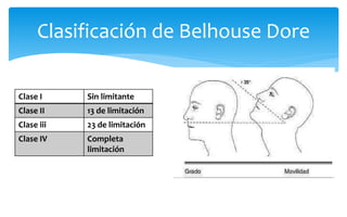 VALORACION DE LA VIA AEREA.pptx