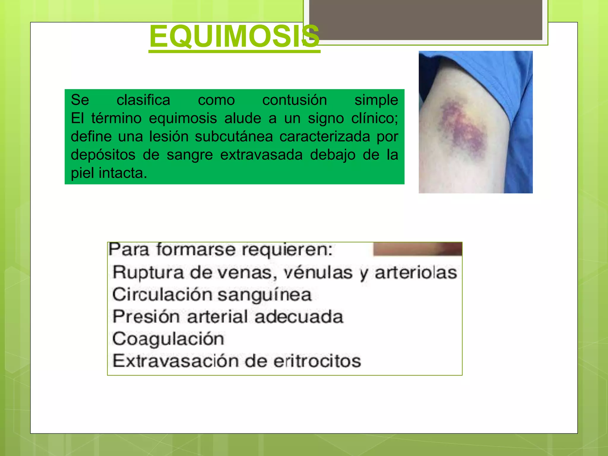 Valoracion medico legal equimosis hematomas | PPTX | Death, Injury, or ...