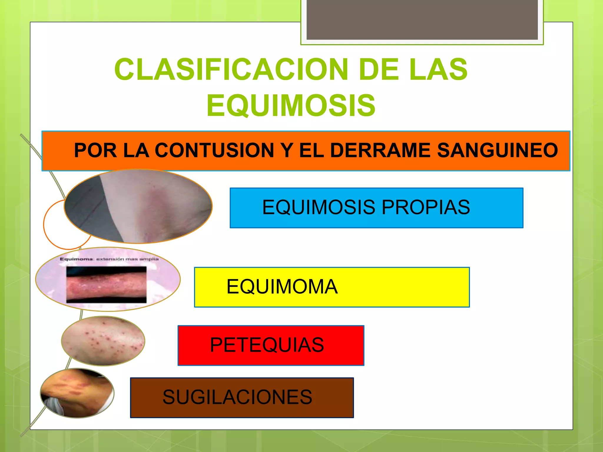 Valoracion medico legal equimosis hematomas | PPTX | Death, Injury, or ...