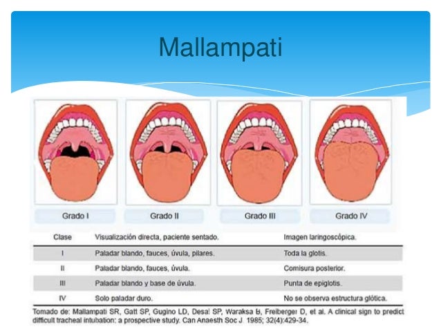 Valoracion preANESTESICA
