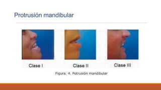 valoracion pre anestesia.pptx