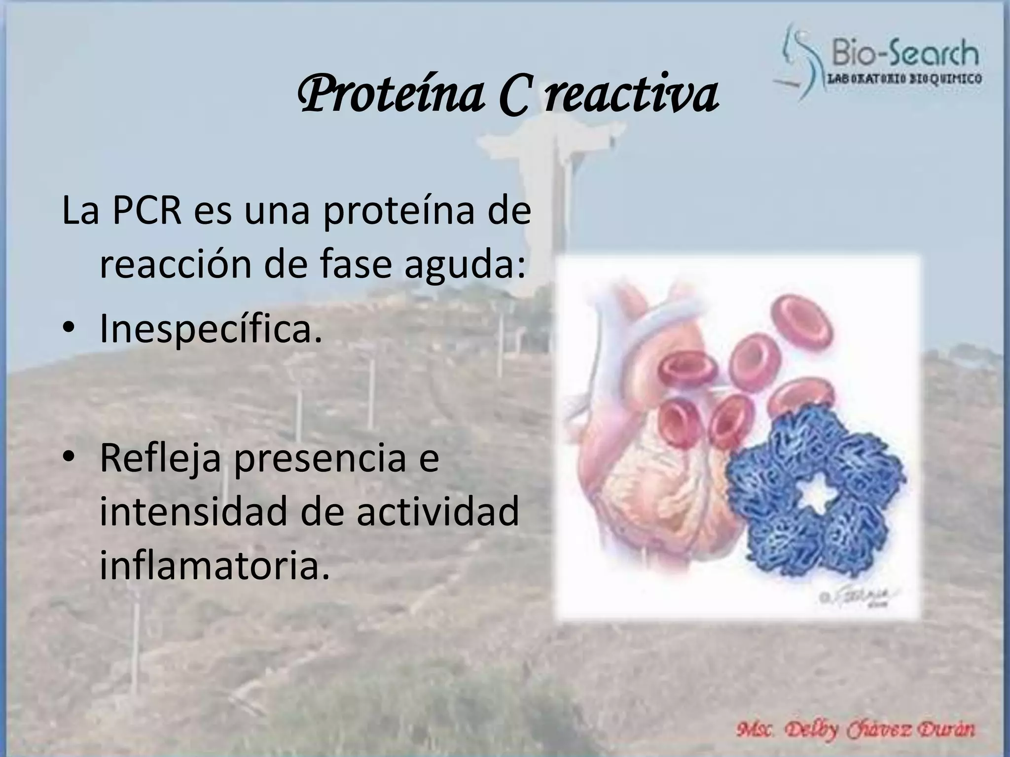 Valor diagnostico de la pcr us | PPTX