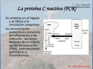 Valor diagnostico de la pcr us | PPTX