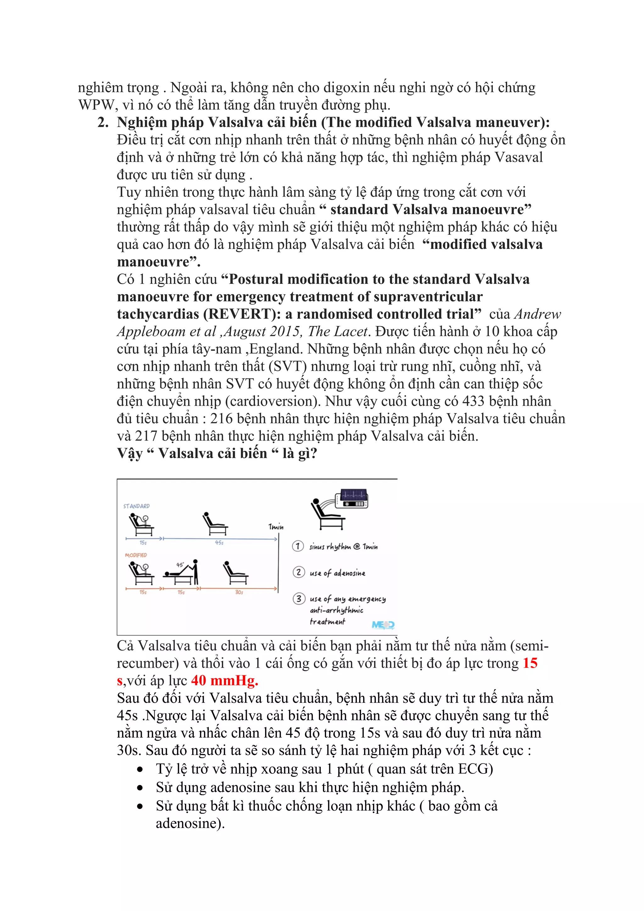 Nghiệm pháp Valsalva cải biến (The modified Valsalva maneuver) | PDF