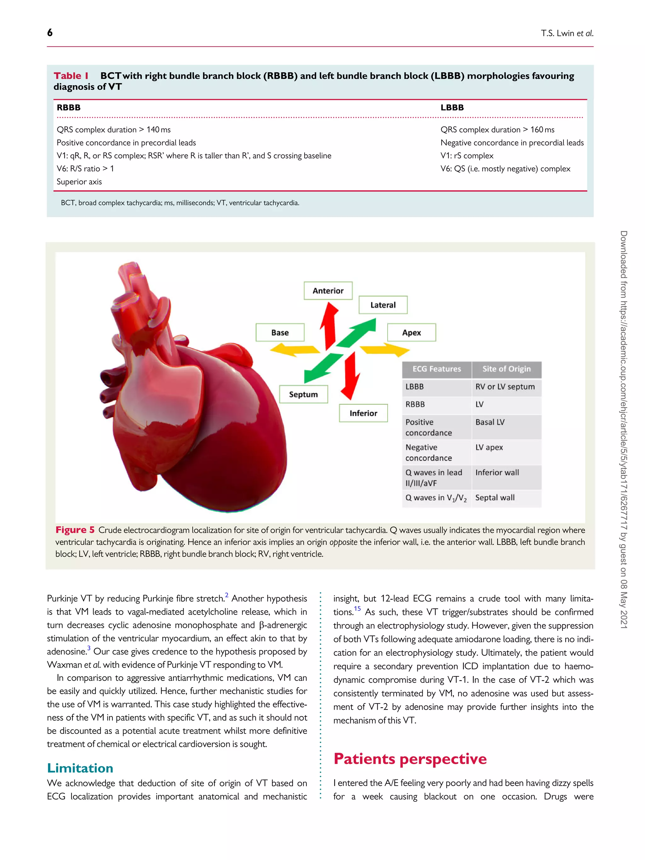 Valsalva manoeuvre in drug refractory ventricular tachycardia | PDF