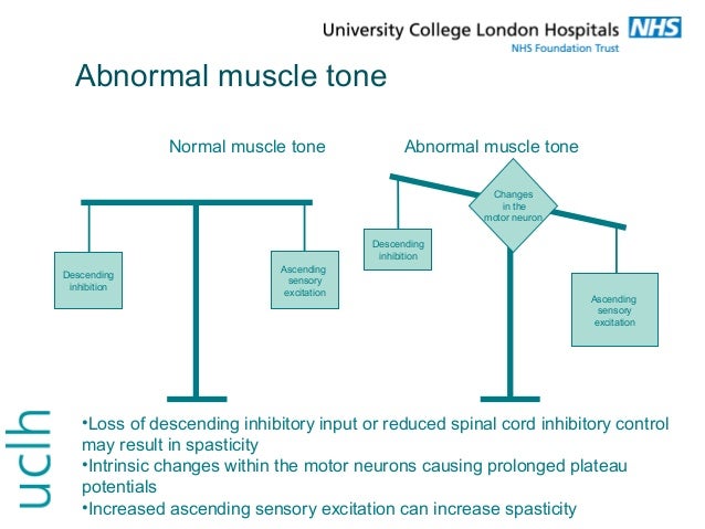 Management of tremor and spasticity in MS