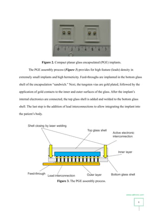 Valtronic Glass Encapsulation for Medical Implants | PDF