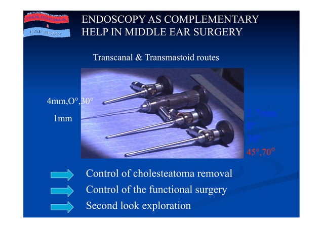 Value Of Ear Endoscopy In Cholesteatoma Surgery.Ppt | Ear, Nose and ...