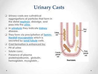 Value of urinalysis in clinical medicine | PPTX