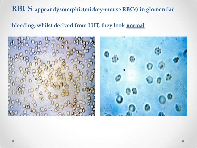 Value of urinalysis in clinical medicine copy