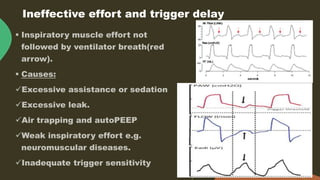 Value of ventilator mode and interface in regulating patient ventilator ...