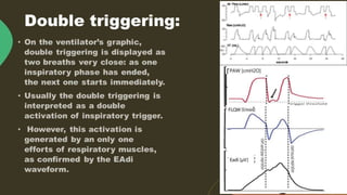 Value of ventilator mode and interface in regulating patient ventilator ...