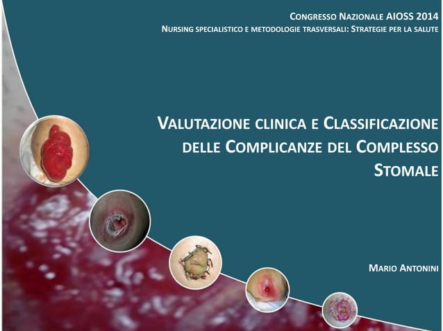 Valutazione clinica e classificazione delle complicanze del complesso ...