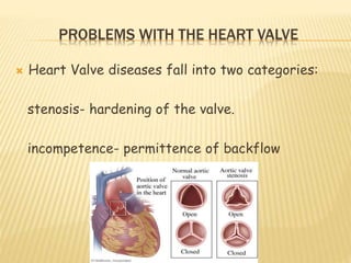HEART VALVE | PPTX | Heart and Cardiovascular Diseases | Diseases and ...