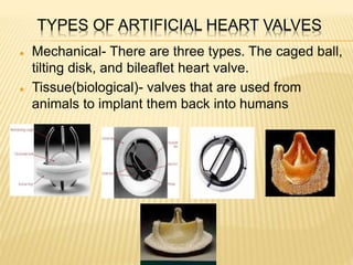 HEART VALVE | PPTX | Heart and Cardiovascular Diseases | Diseases and ...