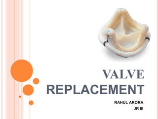 prosthetic valve replacement | PPTX