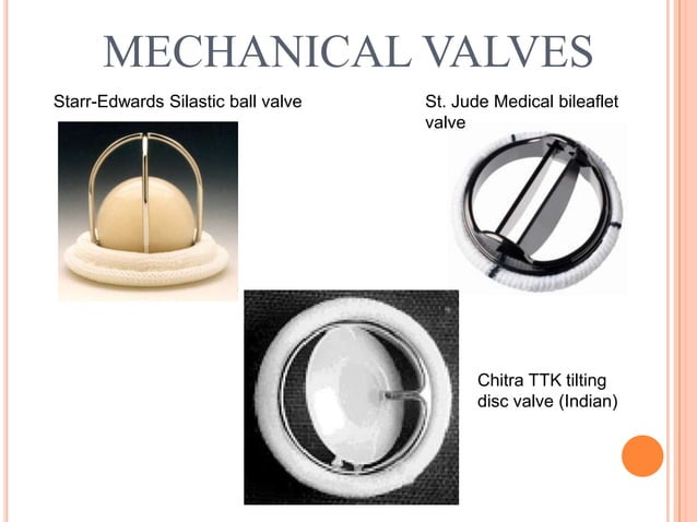 prosthetic valve replacement | PPTX | Heart and Cardiovascular Diseases ...