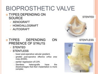 prosthetic valve replacement | PPTX