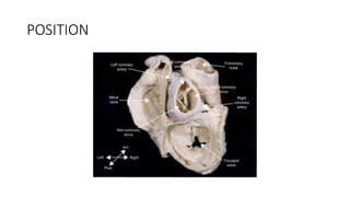 Anatomy of valves of the heart, and surgical implication | PPTX