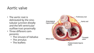 Anatomy of valves of the heart, and surgical implication | PPTX
