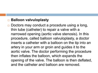 Valvular heart disease/ heart valve disease | PPTX