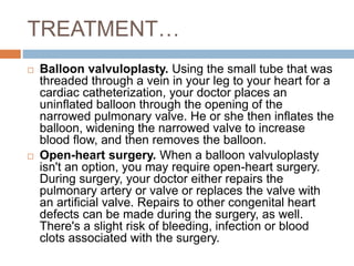 Valvular heart disease/ heart valve disease | PPTX