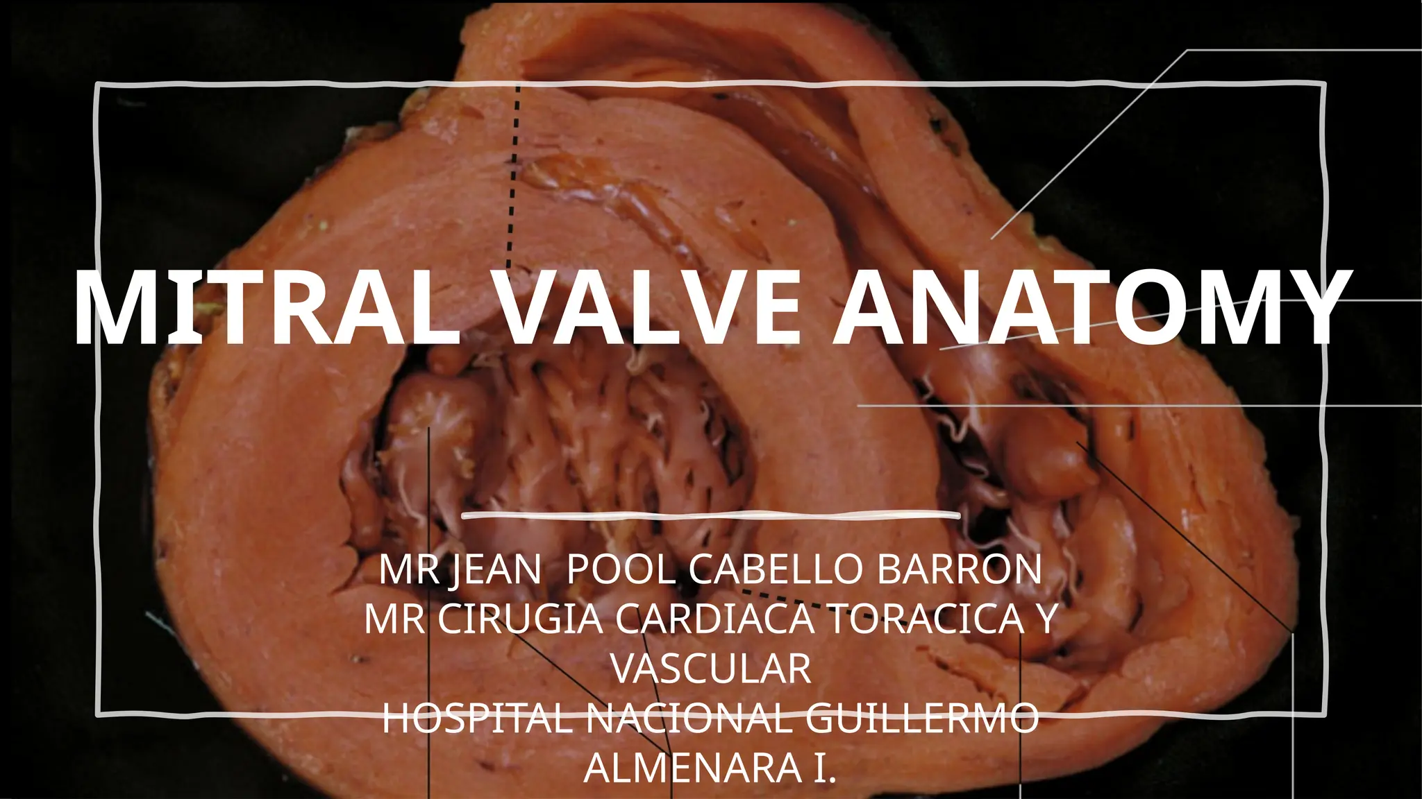VALVULA MITRAL ANATOMIA FUNCIONAL .pptx