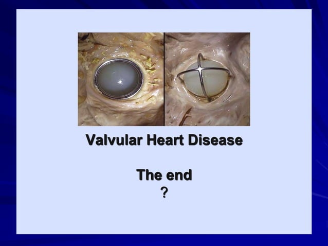 Valvular disease.ppt