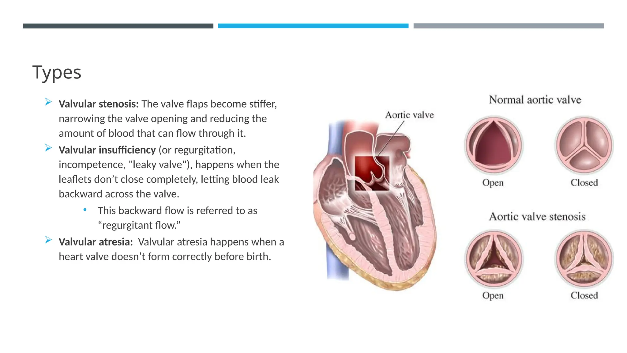 Identify the symptoms and clinical manifestations of Pericarditis, Valvular diseases, Rheumatic ...