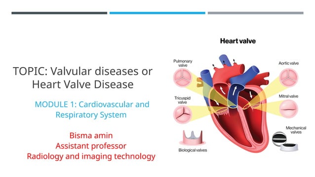 Identify the symptoms and clinical manifestations of Pericarditis ...