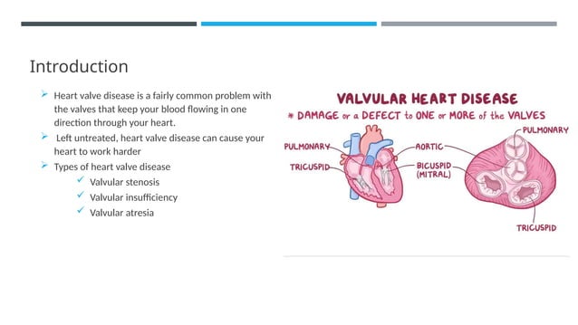 Identify the symptoms and clinical manifestations of Pericarditis ...
