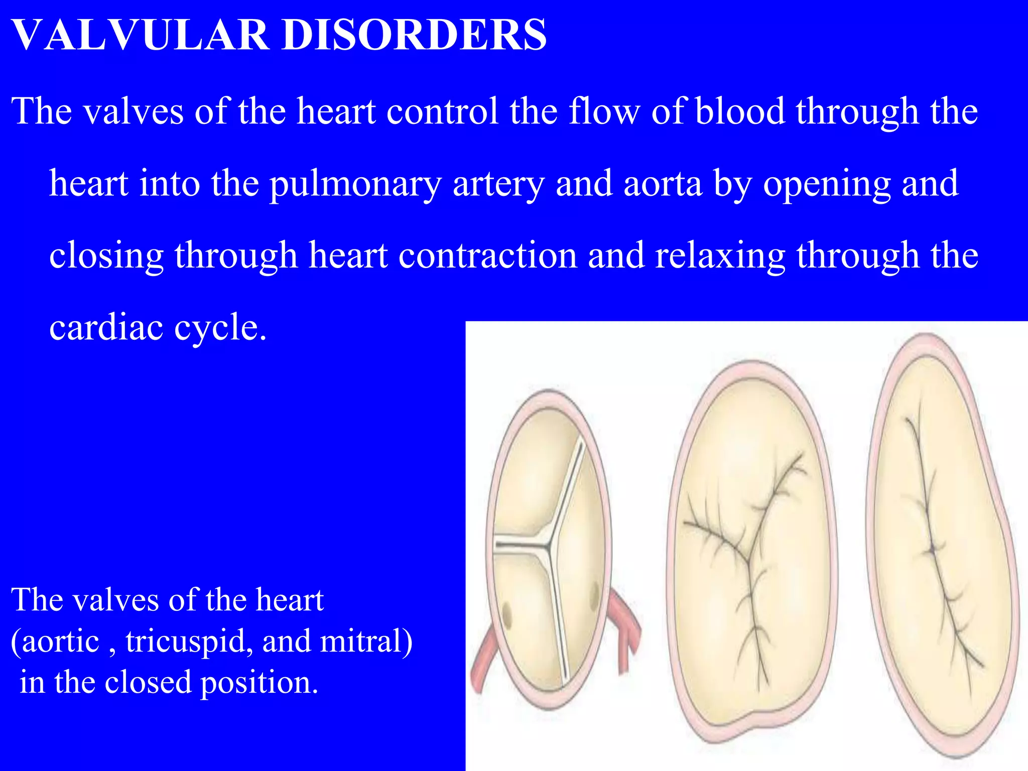 Valvular disorders | PPTX | Heart and Cardiovascular Diseases ...