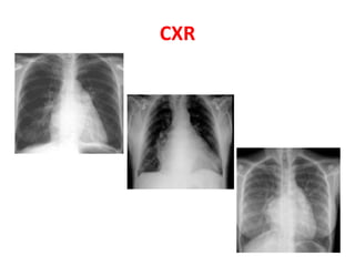 Clinical Approach to Valvular heart dis | PPTX