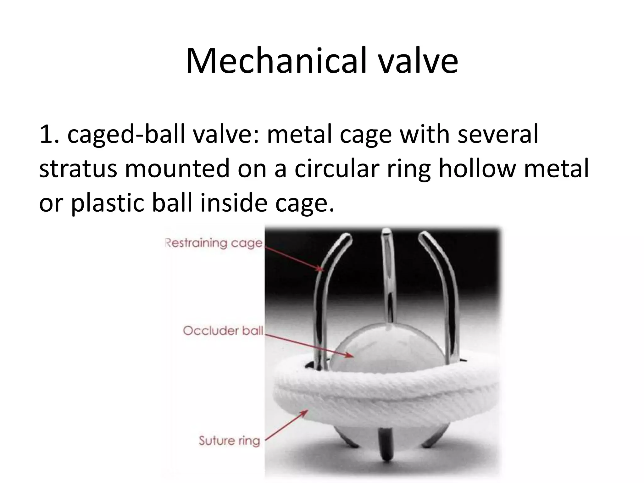 Valvular heart disease | PPTX