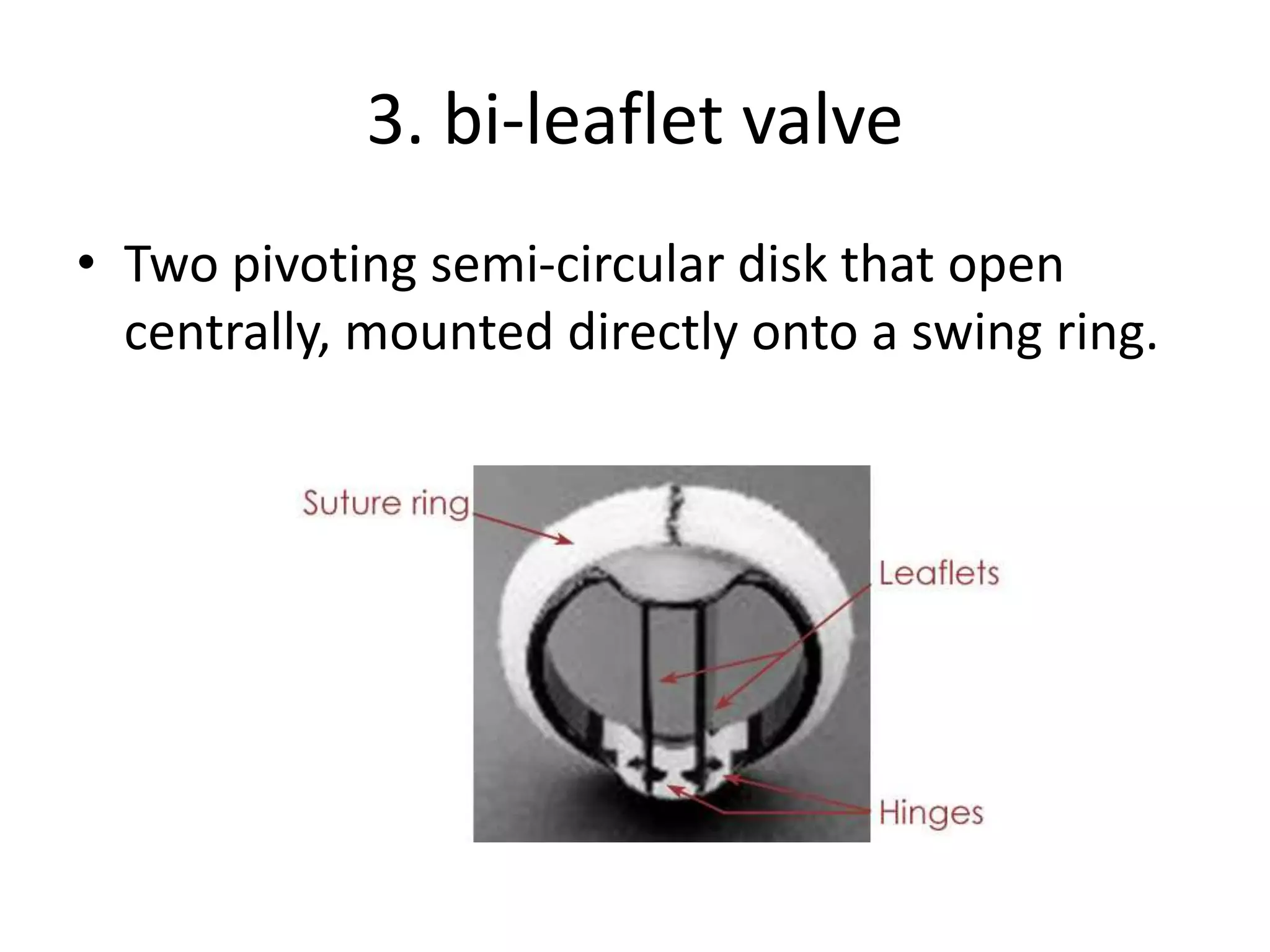 Valvular heart disease | PPTX