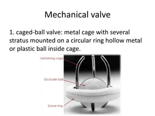 Valvular heart disease | PPTX
