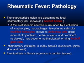 Valvular heart disease | PPT