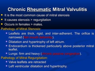 Valvular heart disease | PPT