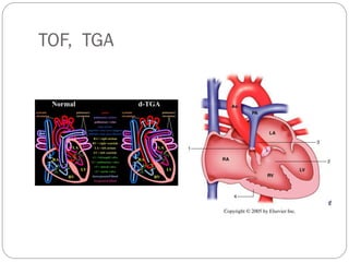 Valvular Heart Disease-1,Lecture 3 (1).pdf