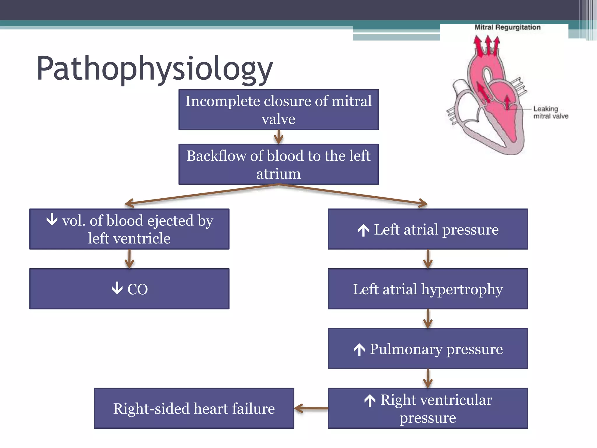 Valvular heart disease | PPTX | Heart and Cardiovascular Diseases ...