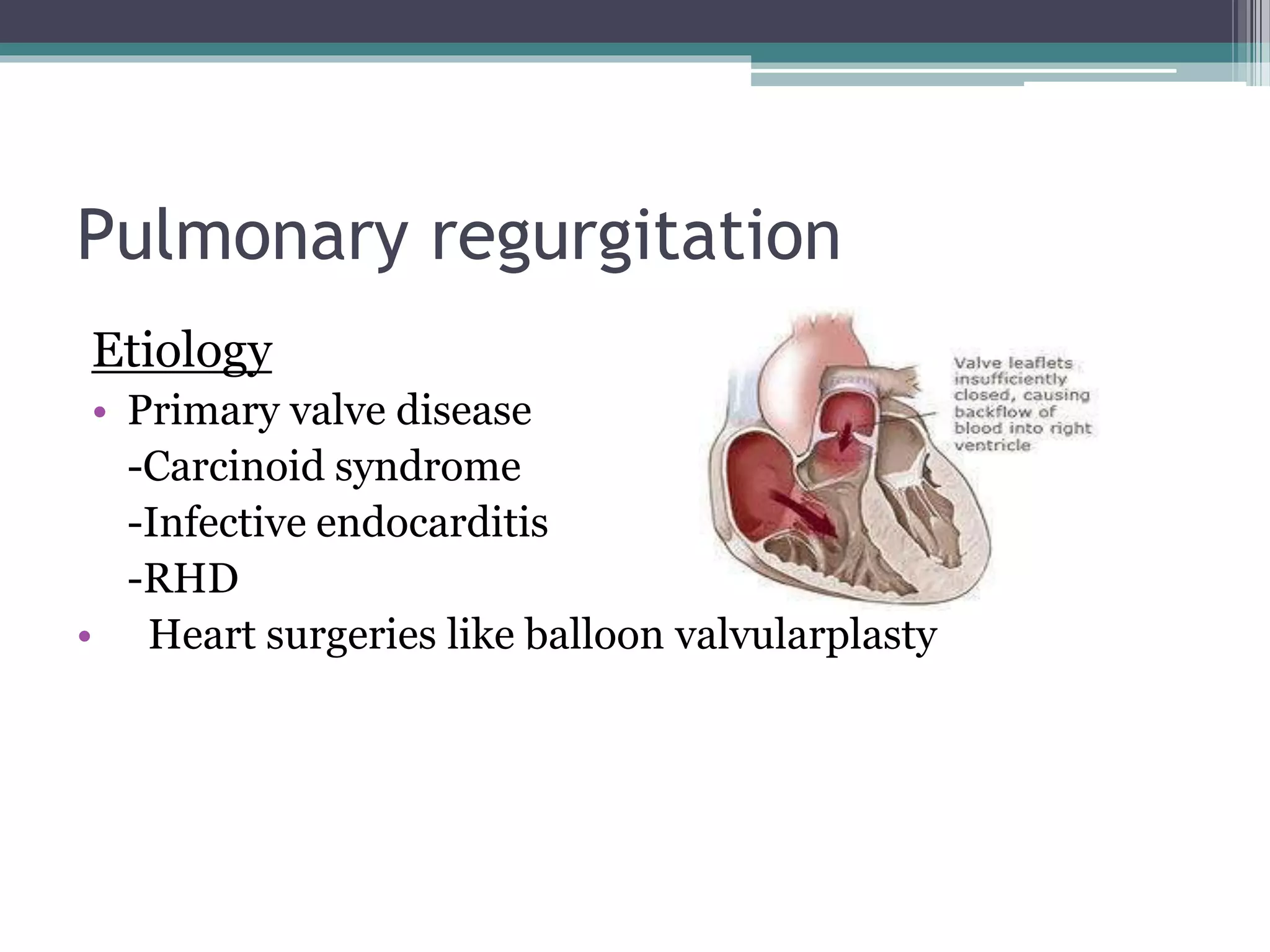 Valvular heart disease | PPTX | Heart and Cardiovascular Diseases ...