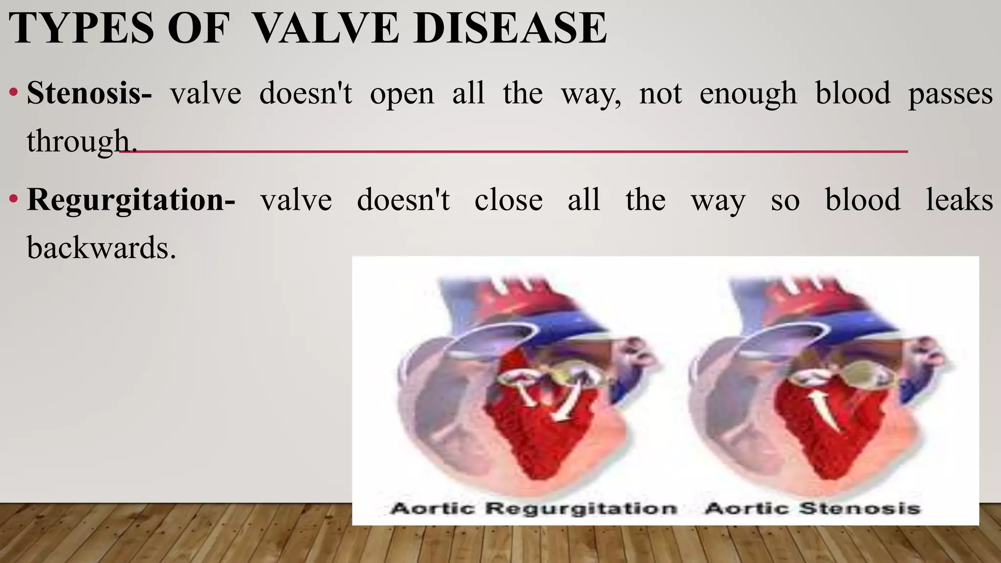 Valvular heart disease.pdf