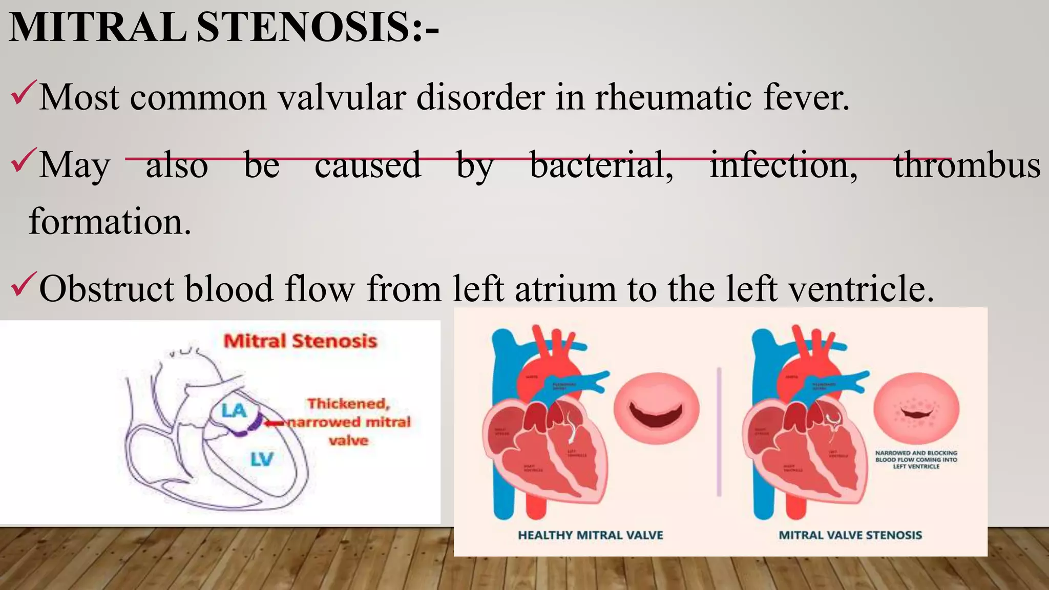 Valvular heart disease.pdf
