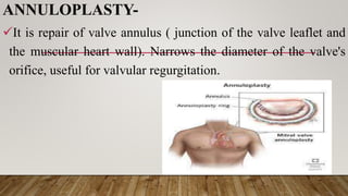 Valvular heart disease.pdf | Heart and Cardiovascular Diseases ...